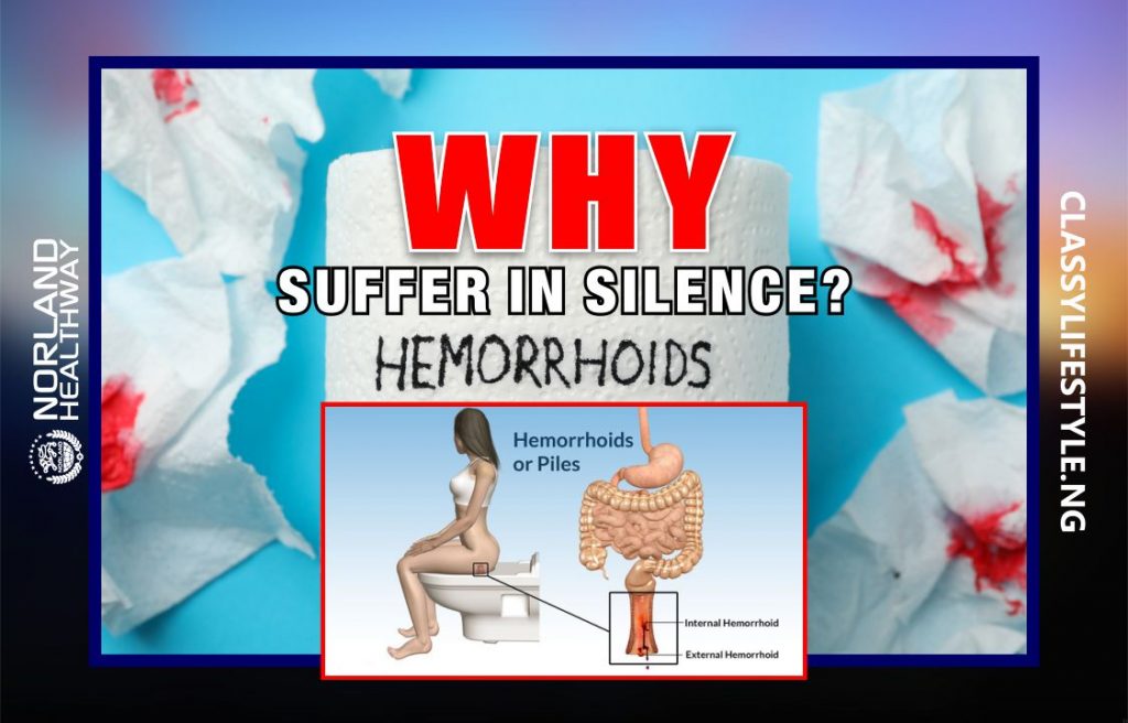 Norland Natural Solution For Piles (hemorrhoids) - Classy Lifestyle